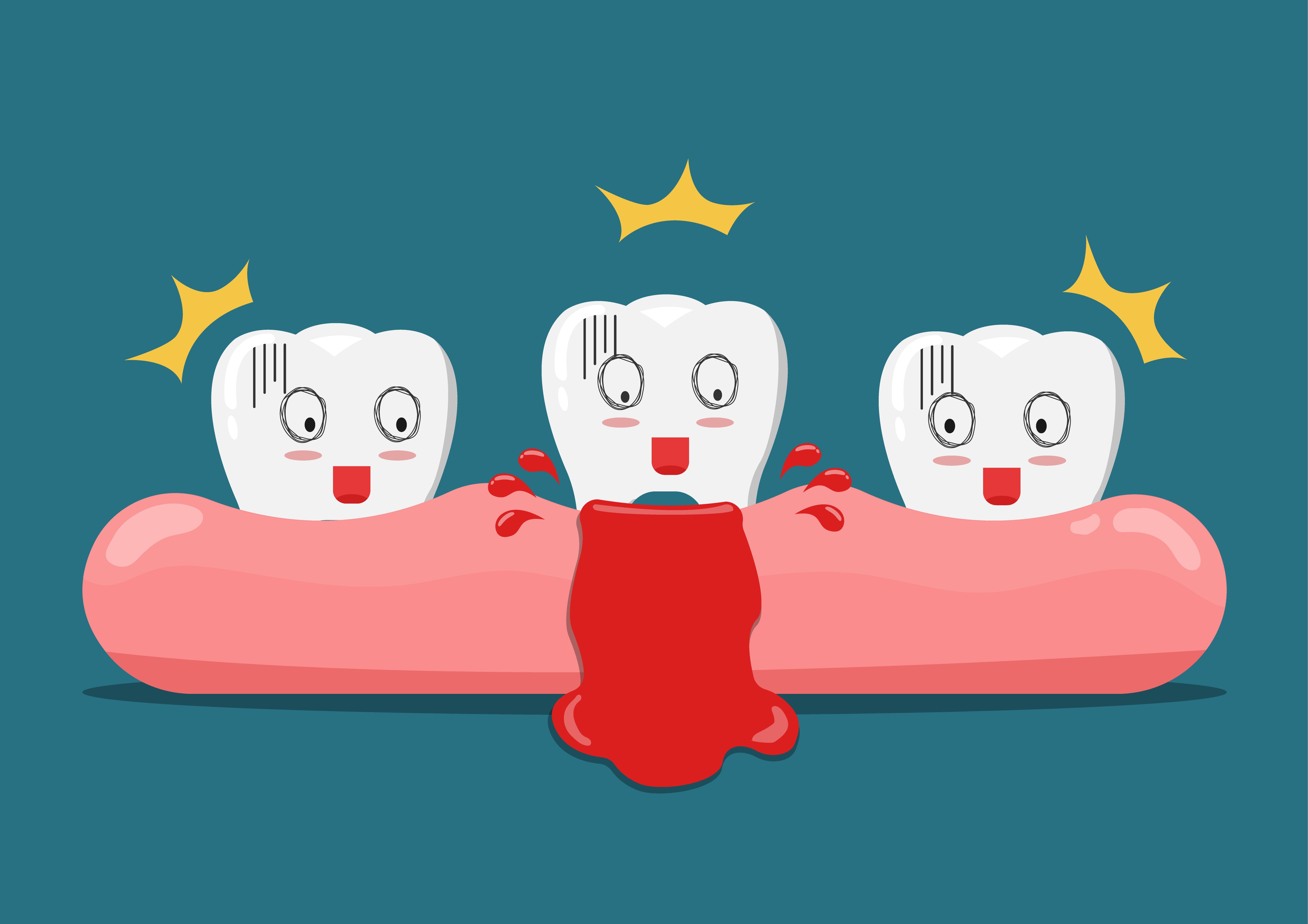 My Gums are Bleeding – TePe Oral Health Care, Inc.