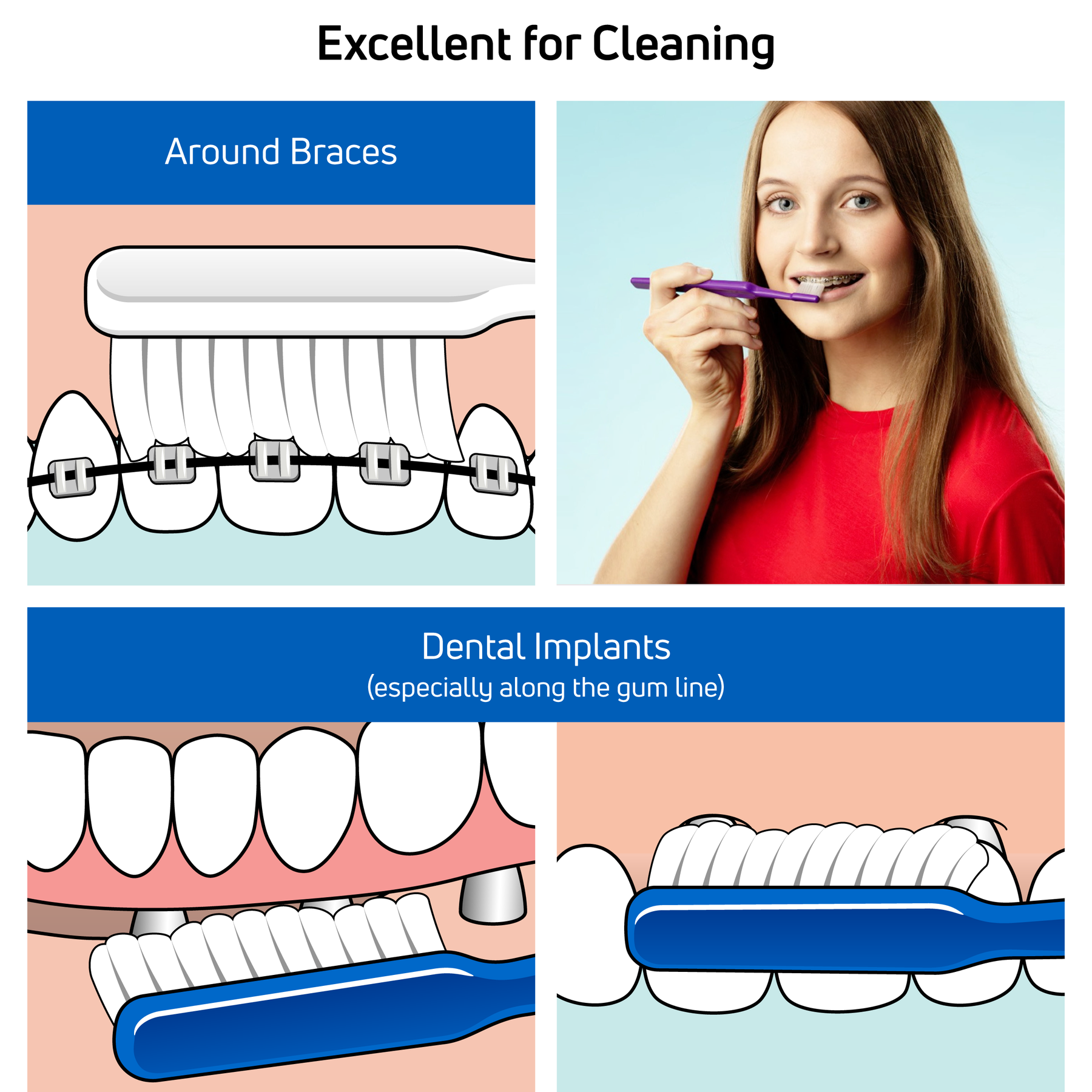 TePe Implant Orthodontic™ - Toothbrush for Dental Implants – TePe Oral ...